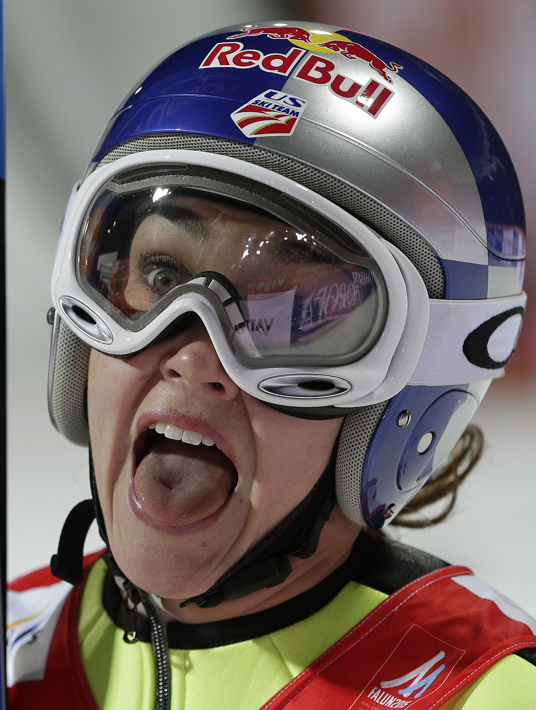 Injury-plagued Sarah Hendrickson aiming for return to ski jumping’s ...